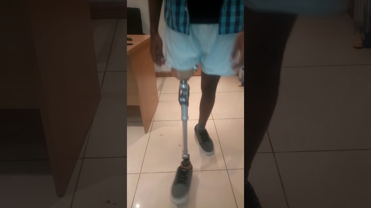 AK prosthesis with a pneumatic knee joint - YouTube