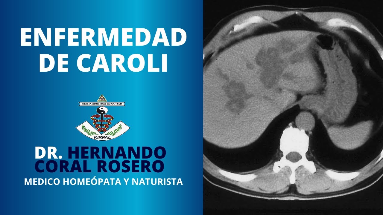 ENFERMEDAD DE CAROLI - YouTube