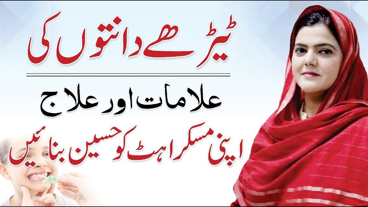 Teeth Diseases And Treatment Crooked Teeth In Urdu Hindi By Dr Asifa Iqbal QAS Health YouTube teeth-diseases-and-treatment-crooked-teeth-in-urdu-hindi-by-dr-asifa-iqbal-qas-health-youtube