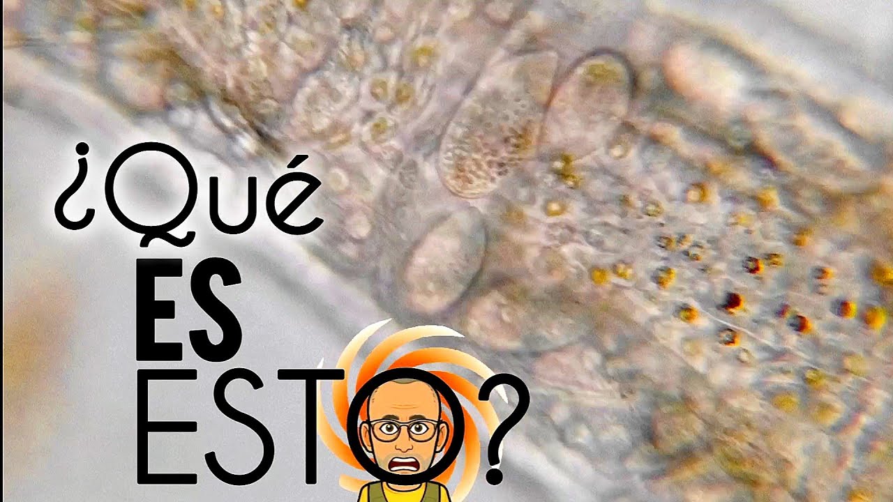 ¿Qué es esto?: Tetrahymena sp. (Ciliophora), endoparásito de Nais ...