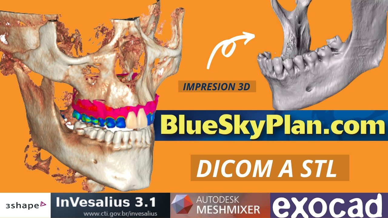 CÓMO CONVERTIR DICOM A STL?😮 IMPRESION 3D- BLUE-SKYPLAN-ODONTOLOGIA ...