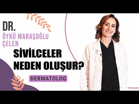 SİVİLCELER NEDEN OLUŞUR? NASIL KURTULABİLİRİZ?