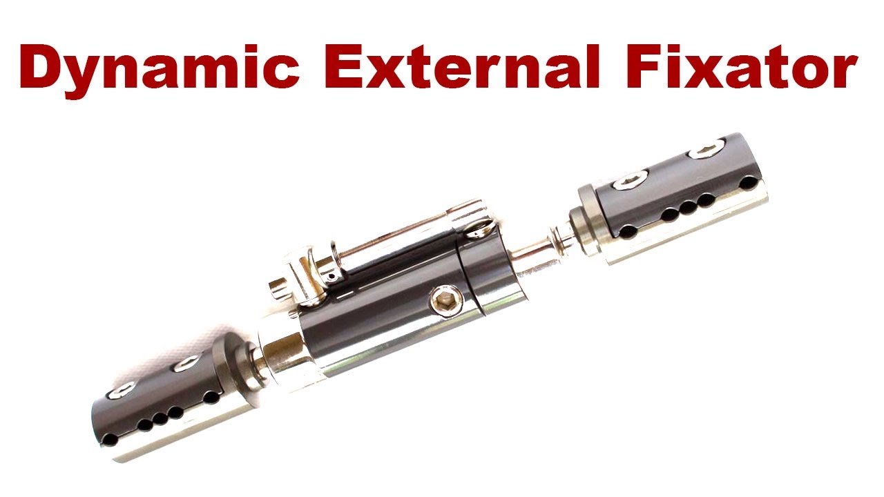 Dynamic External Fixation System | External Fixator | Ext Fixator - YouTube