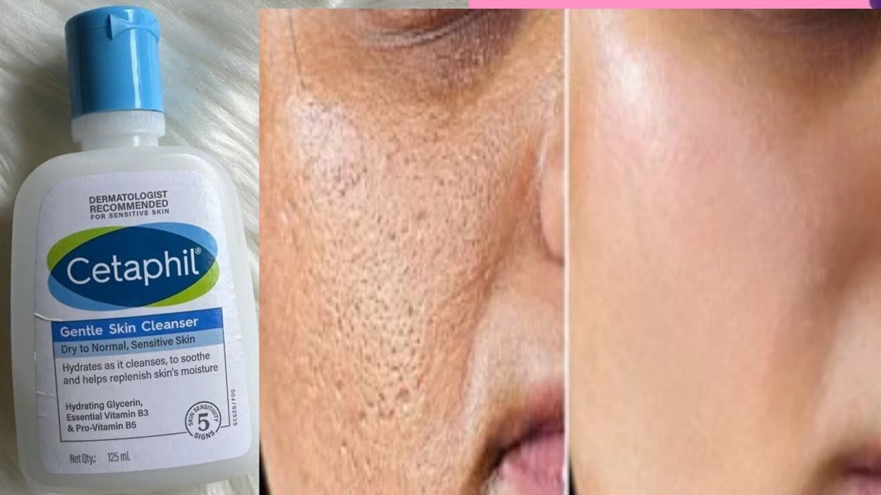 Cetaphil gentle cleanser for pigmentation skin | Cetaphil facewash ...