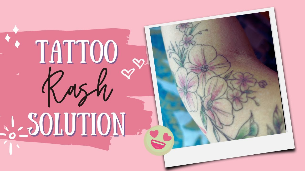 Tattoo Rash Solution - YouTube