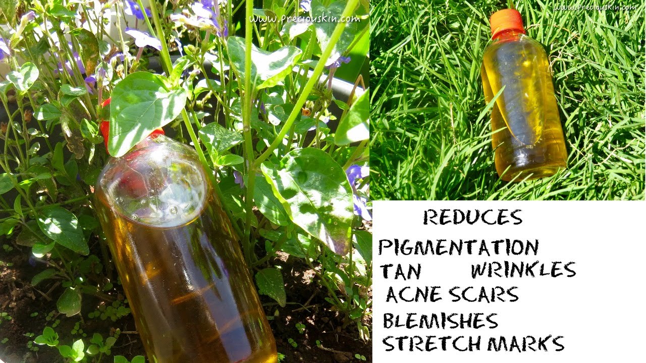 DE TAN Oil to Reduce Pigmentation , Tan ,Stretch Marks,Blemishes and ...
