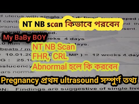 NT scan কিভাবে পরবেন | | NT NB Scan| Pregnancy প্রথম ultrasound ...