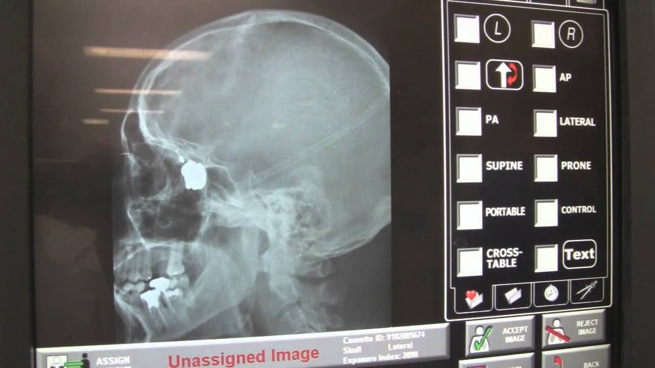 GSW and Bullet to the Head - YouTube