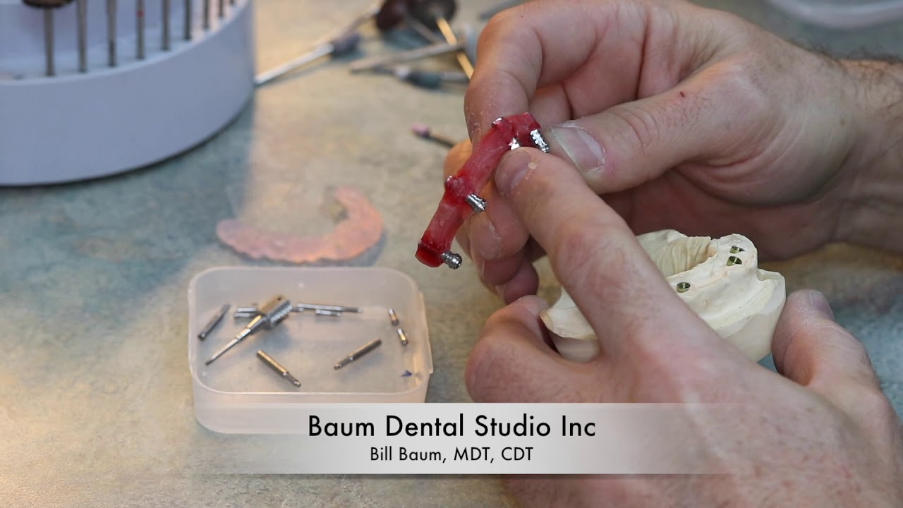 Implant verification jig pt2 - YouTube