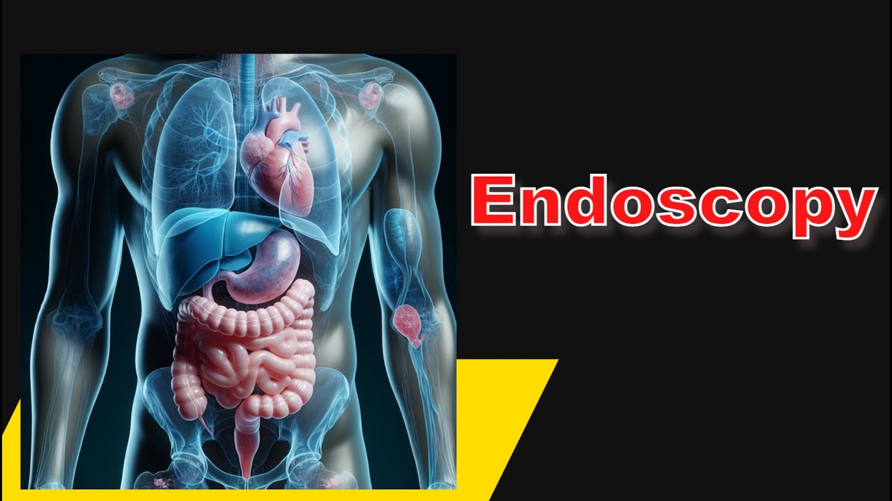 How Doctors Check Inside Stomach | Endoscopy Medical Procedure ...