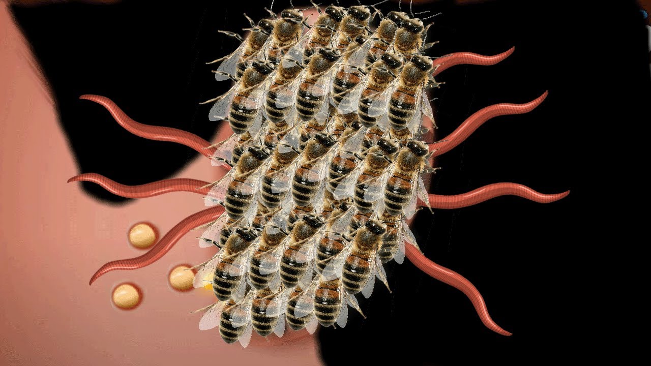 ASMR Remove bee & maggot infected - ASMR Animation Remove Maggot & Bee ...
