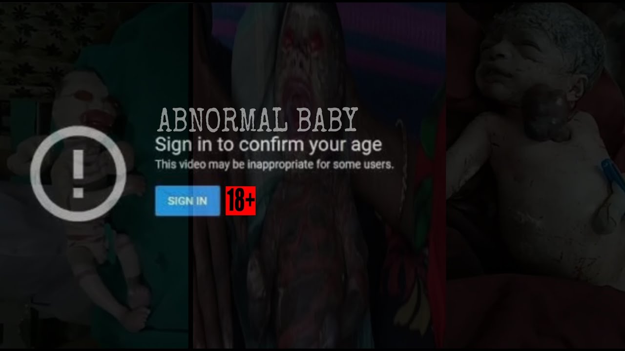 TOP 10 ABNORMAL BABY IN THE WORLD - YouTube