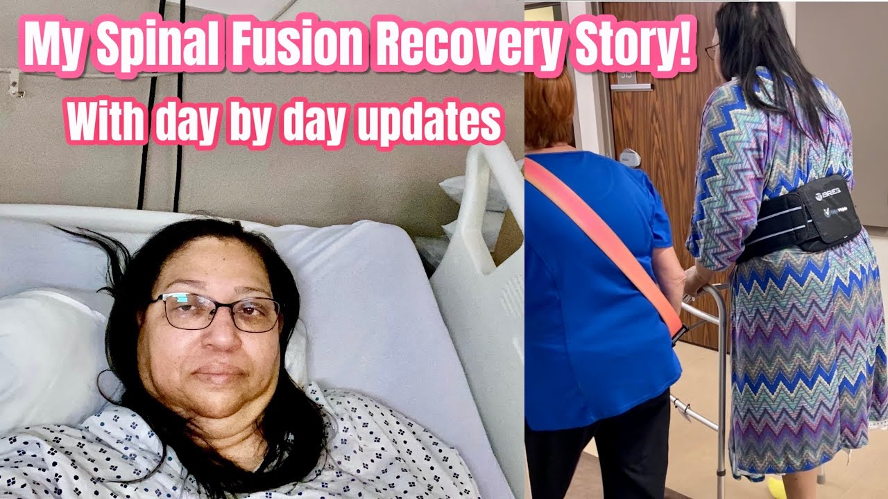 My Spinal Fusion Recovery Story! With Day by Day Updates - YouTube
