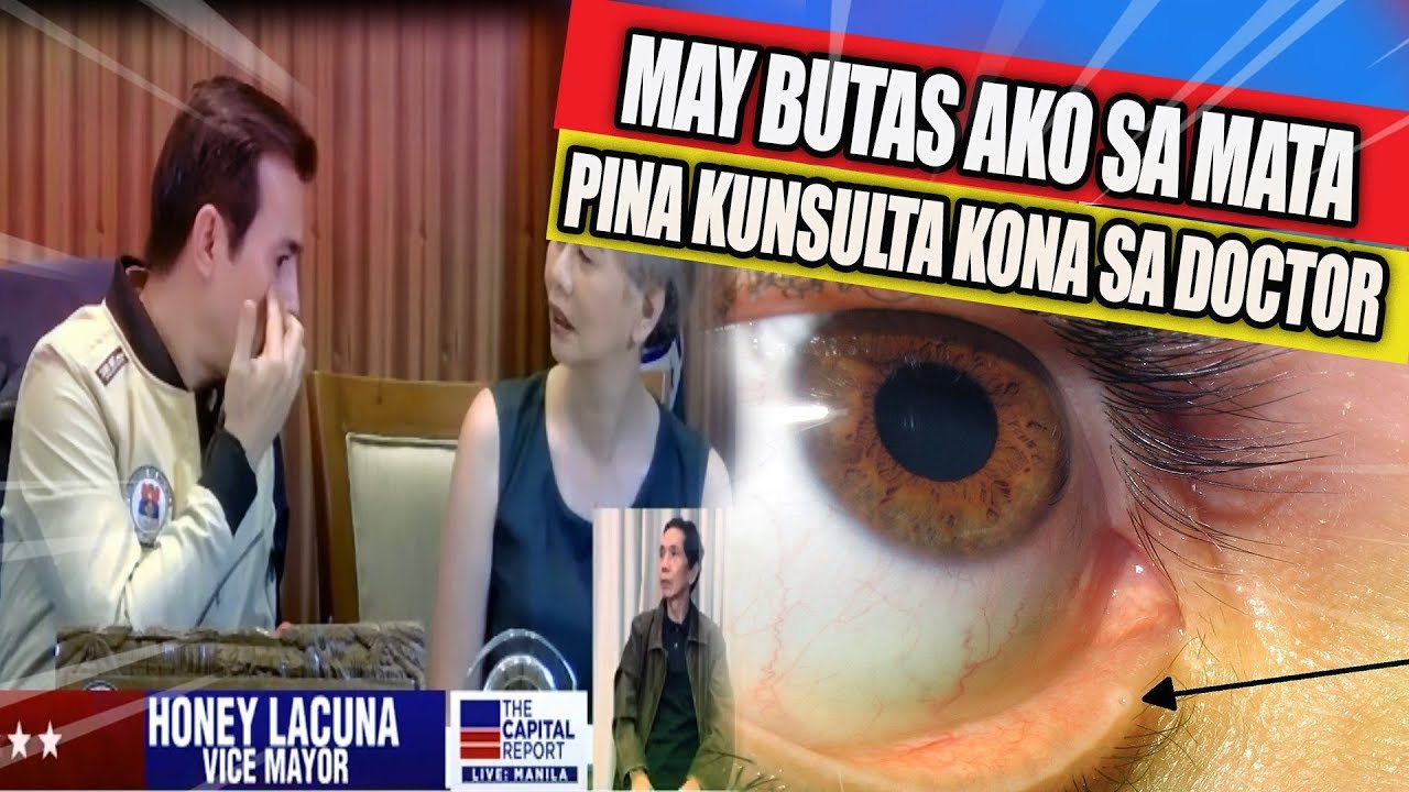 YORME MY BUTAS SA MATA ANONG KLASENG SAKIT KAYA ITO (tignan mo ate ...