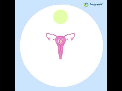 What Happens During Ivf Cycle