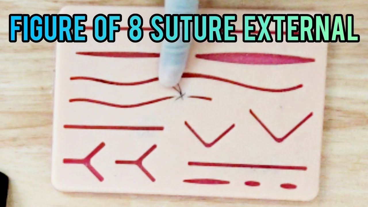 Figure of 8 suture external | Clinical skills - YouTube