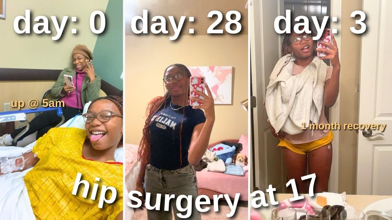 i had hip surgery at 17...AGAIN |3-day vlog *prep, surgery day, 1 month ...