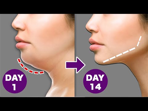DAY 1 OF 14 | DOUBLE CHIN + FACE FAT + NECK FAT | LOOK YOUNGER WITH BABY FACE