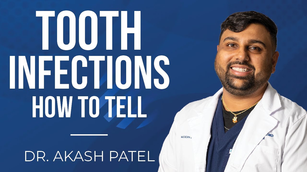Modern Day Smiles: Dr. Akash Patel, DDS - Tooth Infections, How to Tell ...