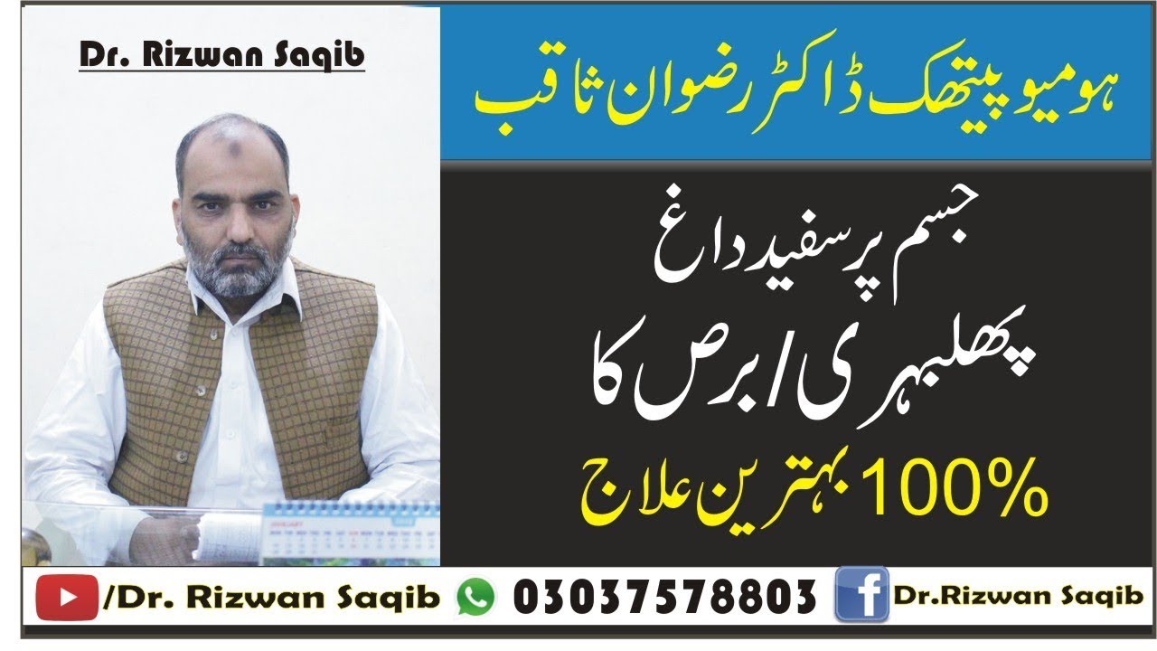 Phulbehri (Phalweri) Ka Ilaj | Leucoderma or Vitiligo Treatment | Dr. Rizwan Saqib | In Urdu ...