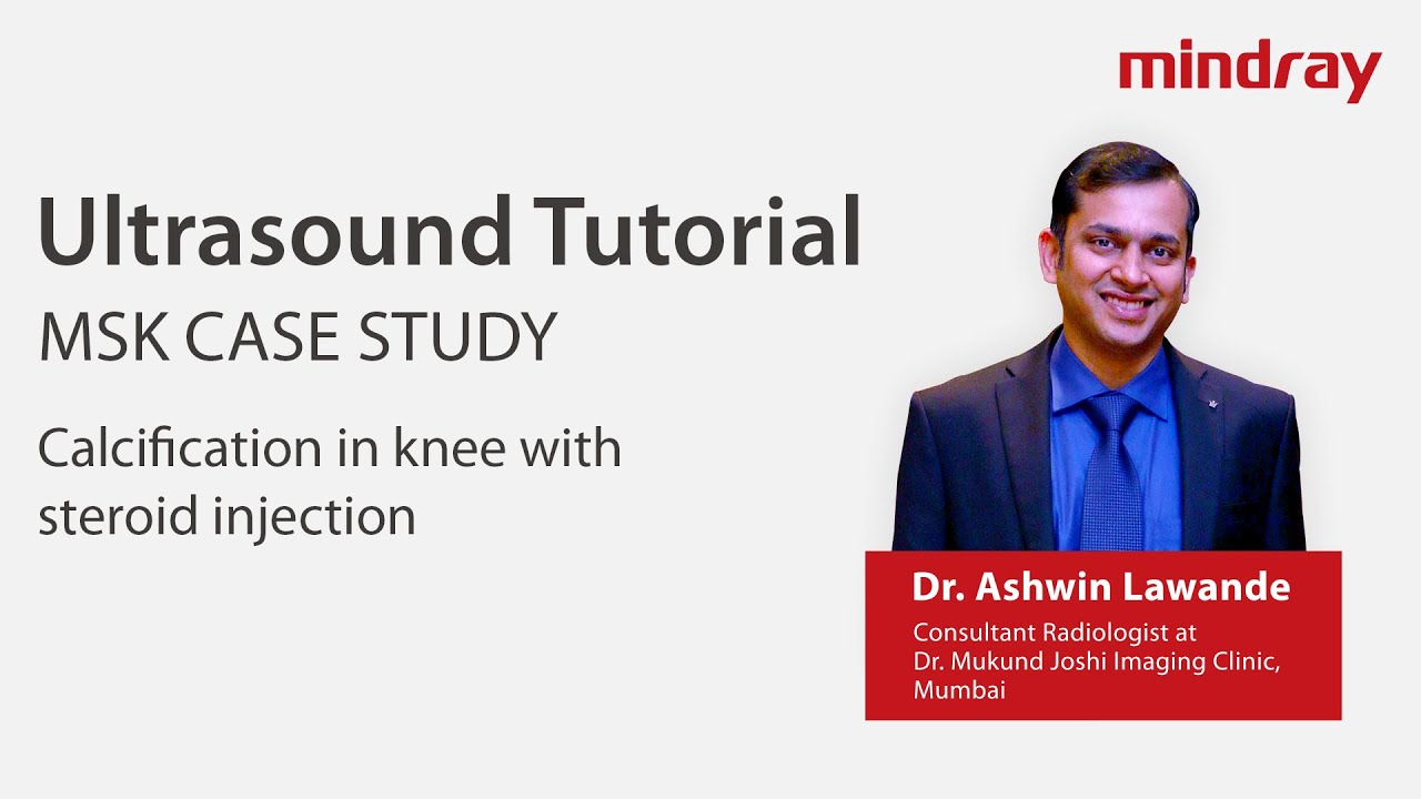 MSK Intervention Case Study using Mindray Resona 7 for calcification in ...