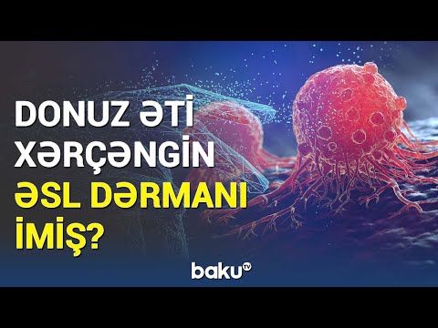 Xərçəng xəstəsi bu üsulla sağaldı | Onkoloji xəstəliklərin müalicəsində ağlasığmaz addım