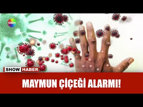 Dünyanın yeni korkulu rüyası: Maymun Çiçeği