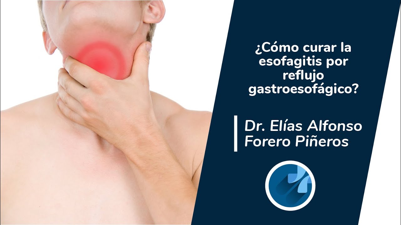 ¿cómo Curar La Esofagitis Por Reflujo Gastroesofágico Youtube