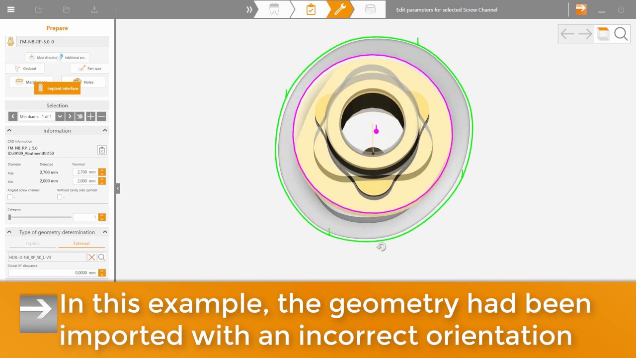 hyperDENT Toolbox DE/ENG - Importing exchange geometries - YouTube