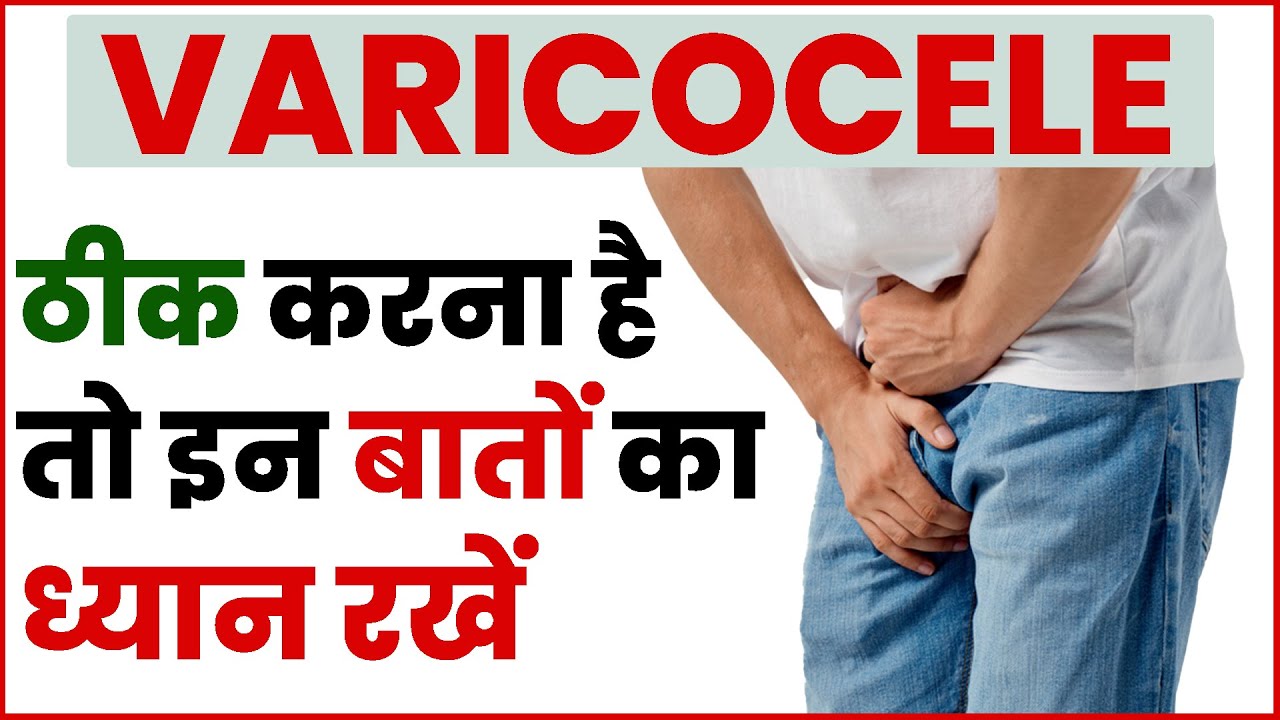Varicocele ठीक करना है तो इन बातों का ध्यान रखें Varicocele Natural