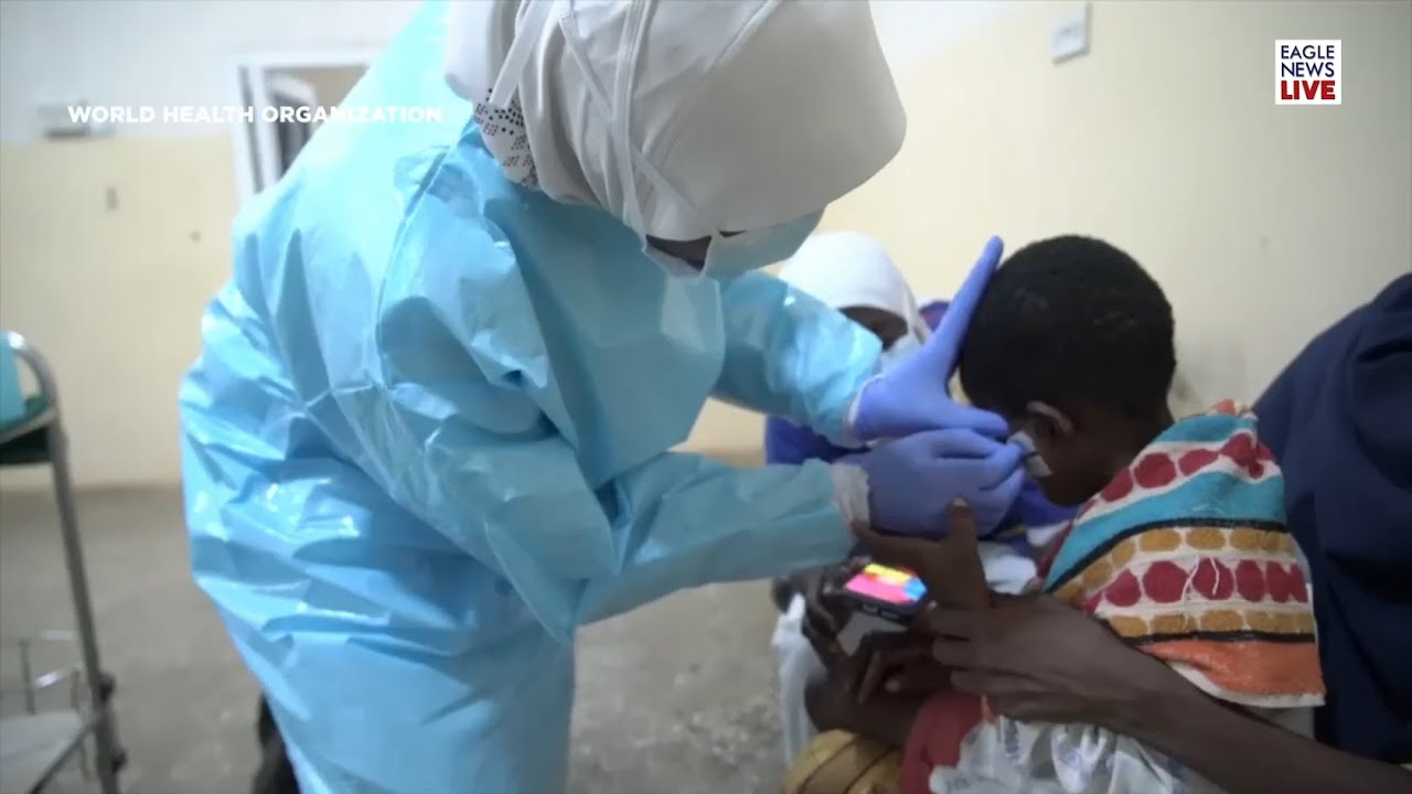 Noma Officially Recognized As Neglected Tropical Disease - YouTube