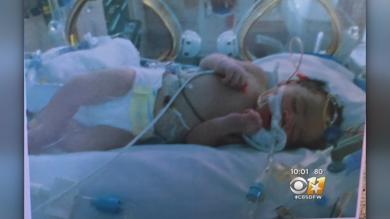 Baby Fighting For Life, Delivered After Mother Killed - YouTube