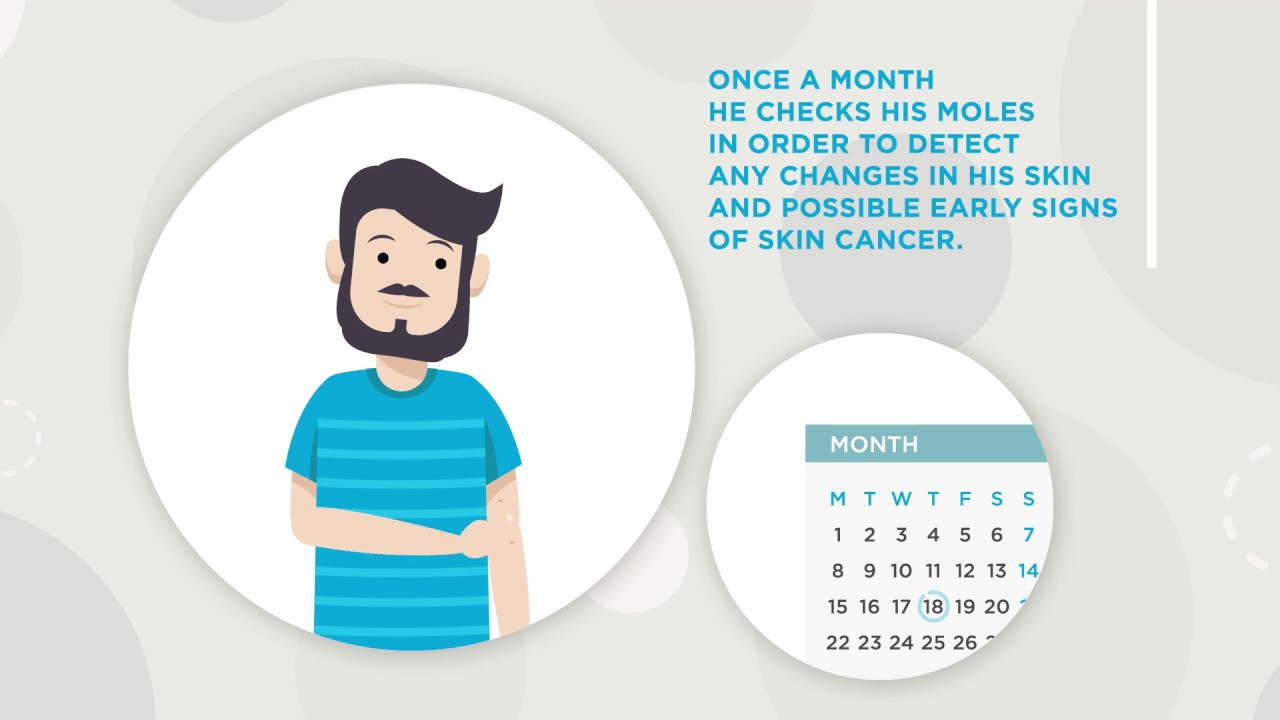 ABCDE rule: keep an eye on your moles – Hirslanden Private Hospital ...