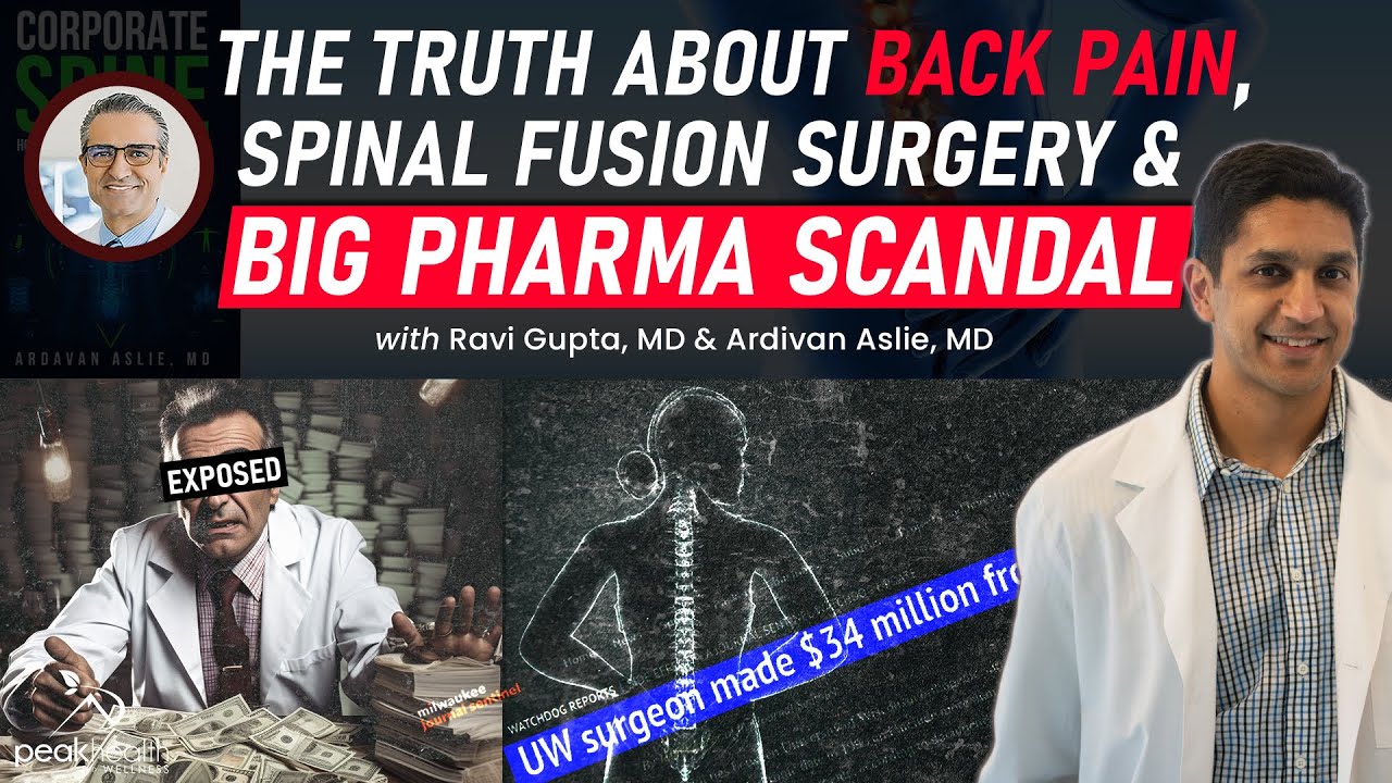 The Truth Behind Spine Surgery: A Shocking Revelation with Ravi Gupta ...
