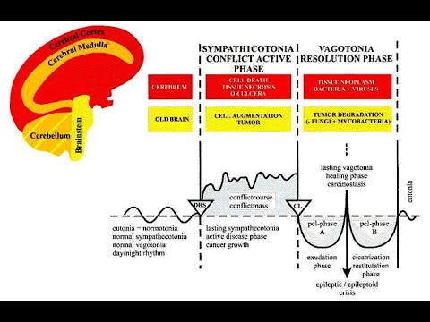 German New Medicine Intro - YouTube