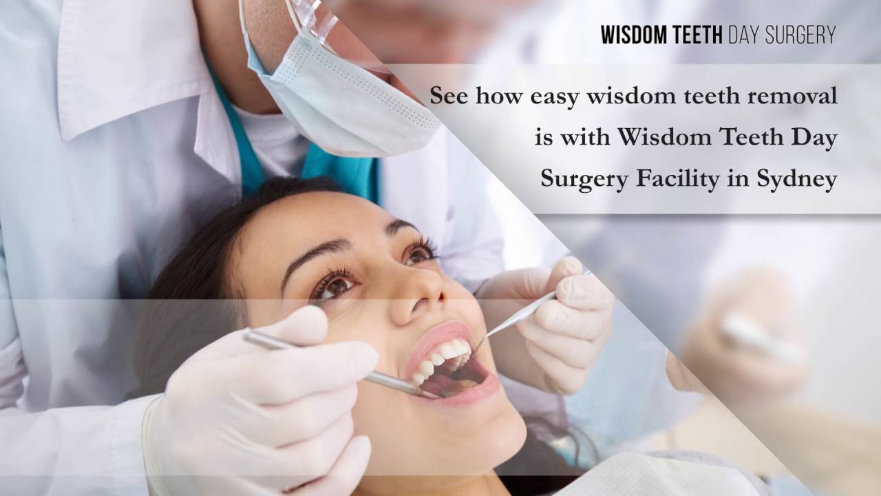 Watch Now to See How Easy Wisdom Teeth Removal Can Be - YouTube