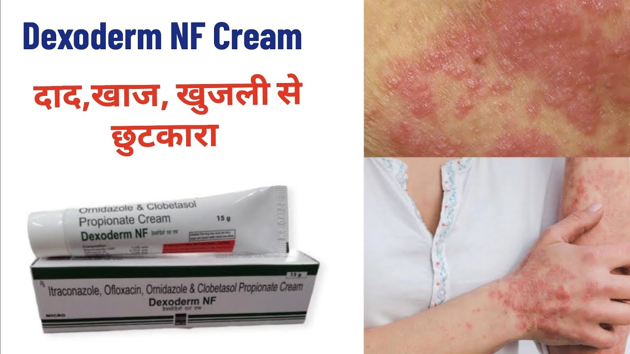 Dexoderm NF Cream For fungal infection दाद,खाज,खुजली #fungalinfections ...