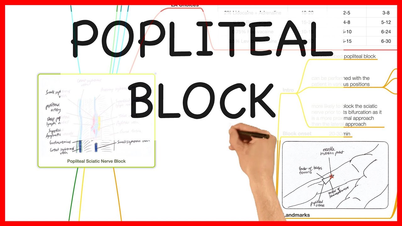POPLITEAL SCIATIC NERVE BLOCK -PRACTICAL CONDUCT SERIES - YouTube