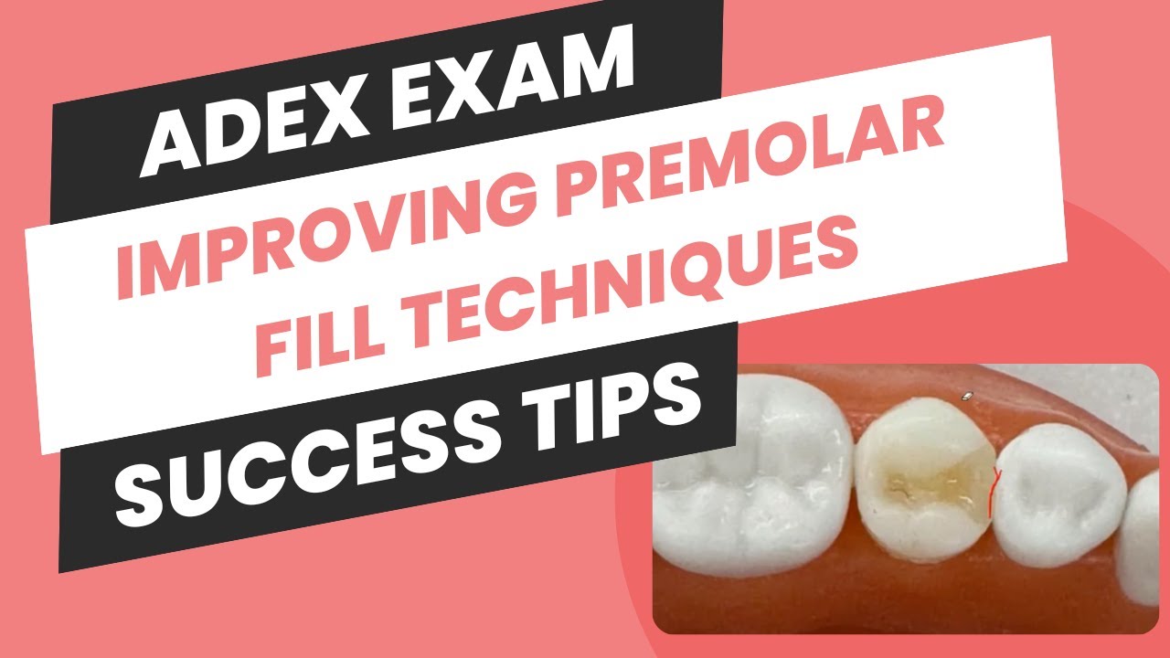 Improving Premolar Fill Techniques: Key Adjustments for ADEX Exam ...
