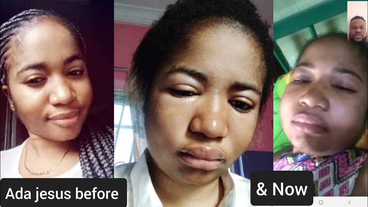 Ada Jesus Comedy As God lives, you shall also live to testify his ...