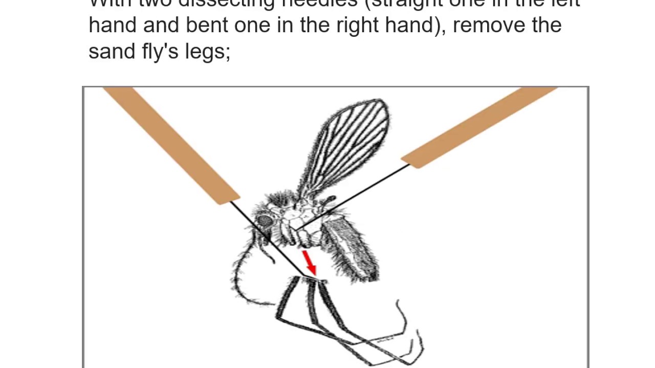 Dissecting and Mounting of Sandflies - YouTube
