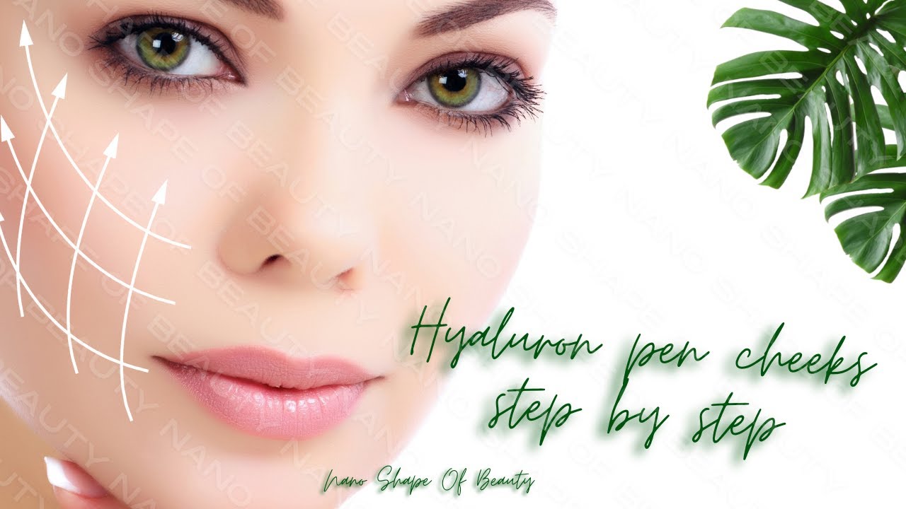 Hyaluron pen cheeks step by step - YouTube