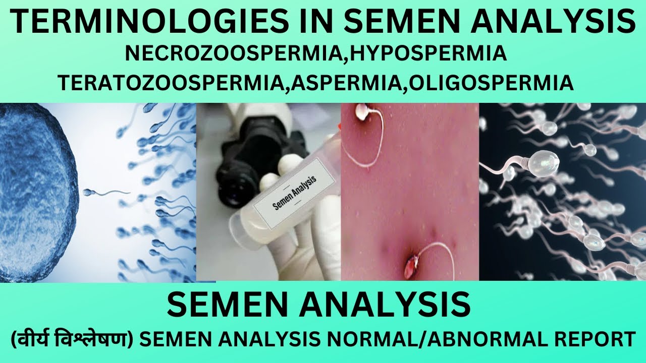TERMINOLOGIES USED IN SEMEN ANALYSIS.OLIGOSPERMIA,AZOOSPERMIA,ASPERMIA ...