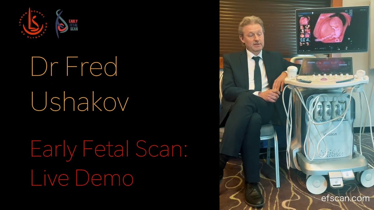 Dr Fred Ushakov - Early Fetal Scan Live DEMO - VOLUSON Expert 22 - YouTube