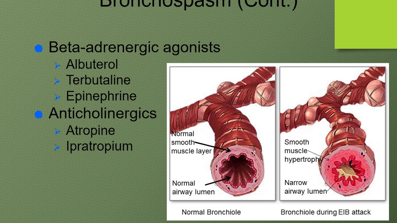 Chapter 16 General Anesthesia - YouTube
