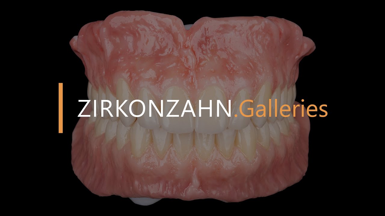 Florence Zircoprox Denture System – All made in zirconia | Zirkonzahn ...