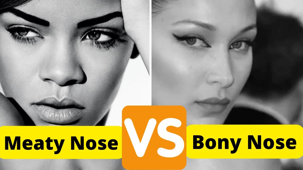 Bony Nose VS Meaty Nose Surgery - YouTube