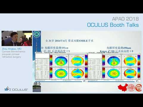 Zhou Xingtao: Corneal biomechanics pre-post corneal refractive surgery
