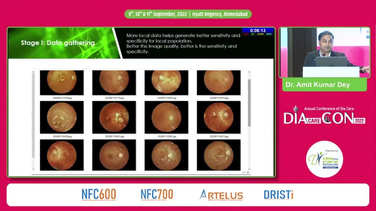 Dr. Amit Kumar Dey: Role of AI in Screening of Diabetic Retinopathy ...