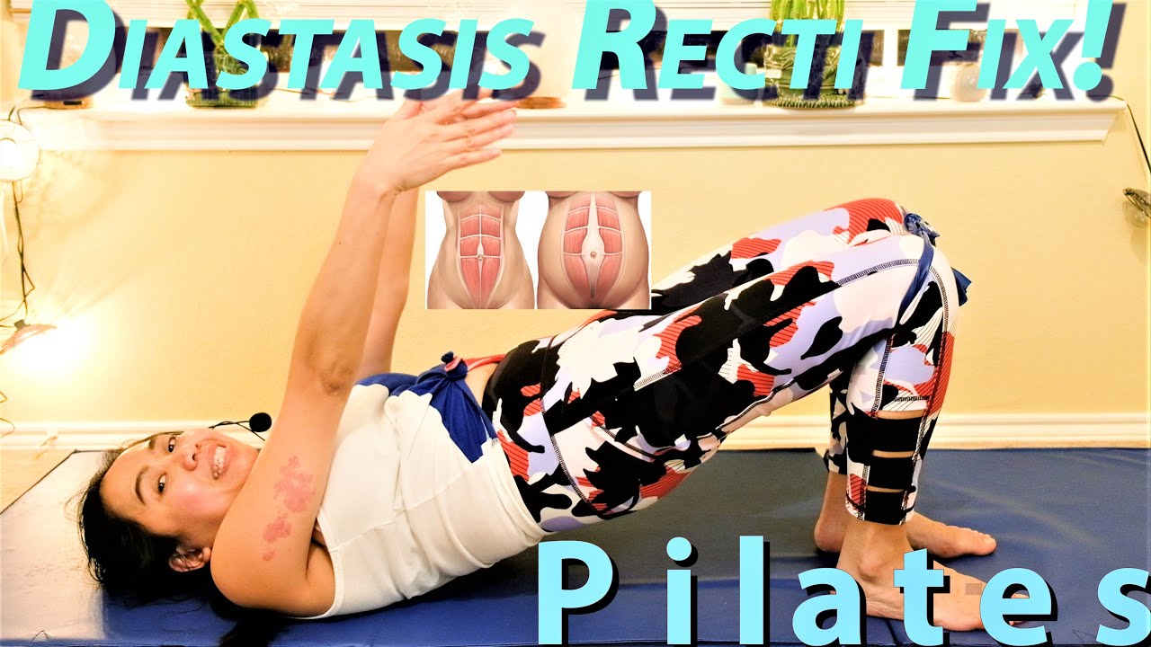 Diastasis Recti 5 Exercises To Close The Gap For Postpartum - YouTube